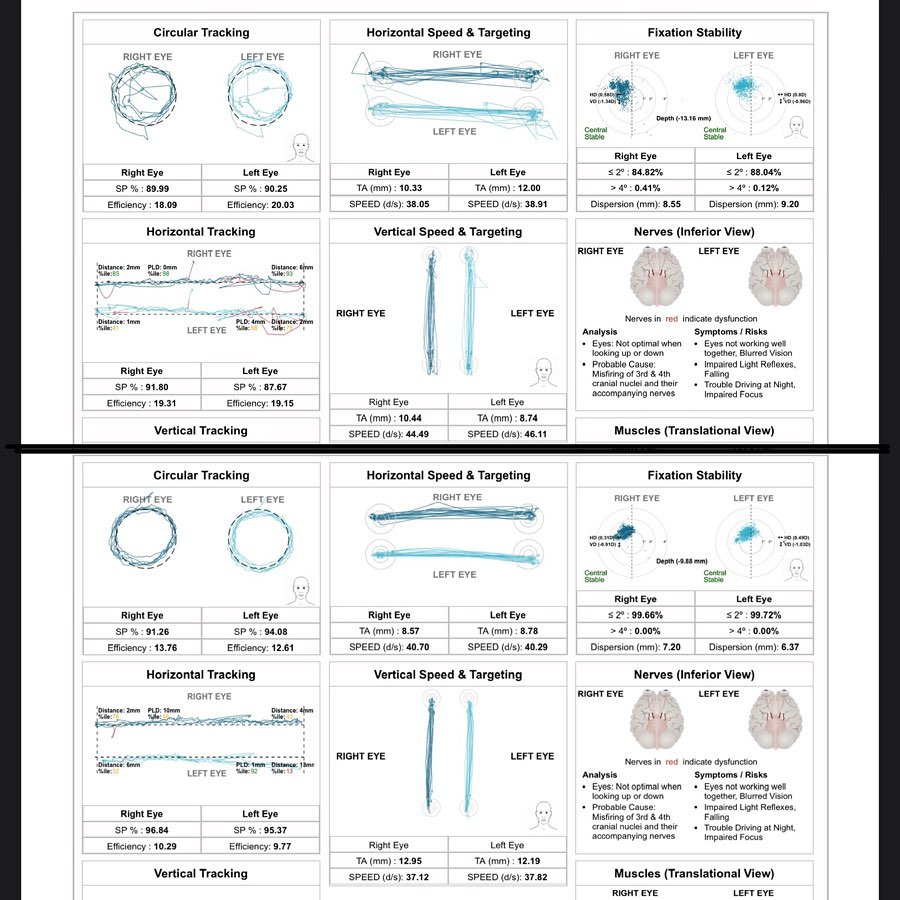 Right Eye – Cobblestone Medicine and Rehab Centre